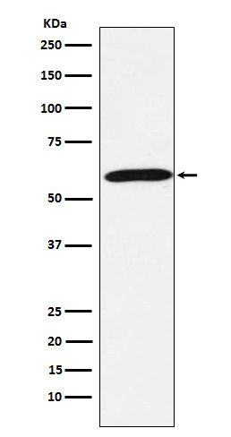 Calsequestrin 1 Antibody - 铂班生物