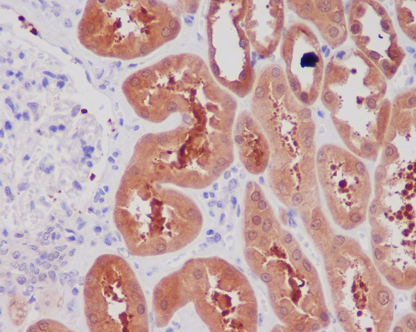 NGF Antibody - 铂班生物