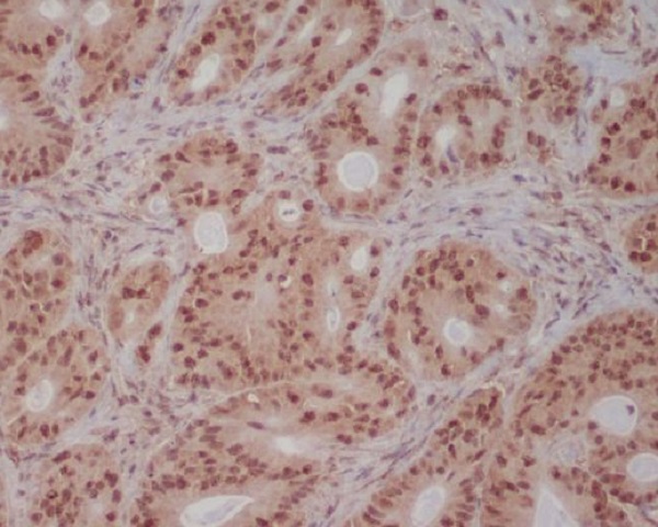 PI3 Kinase p85 beta Antibody - 铂班生物